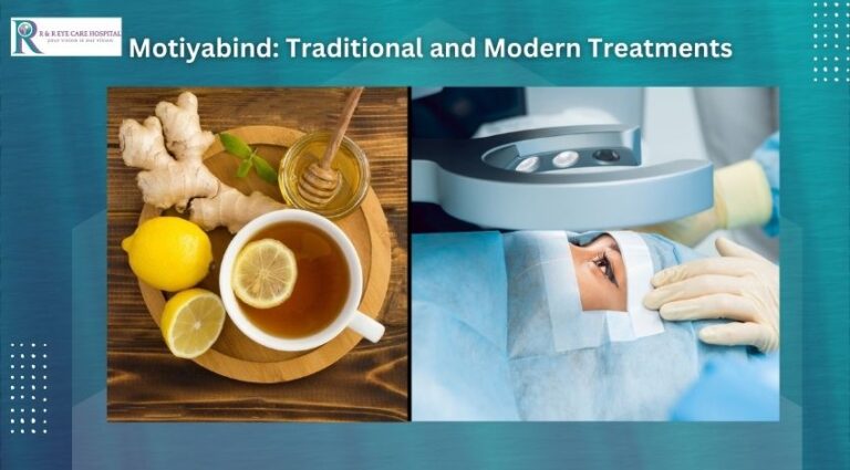 Motiyabind: Traditional and Modern Treatments - RNREYECARE