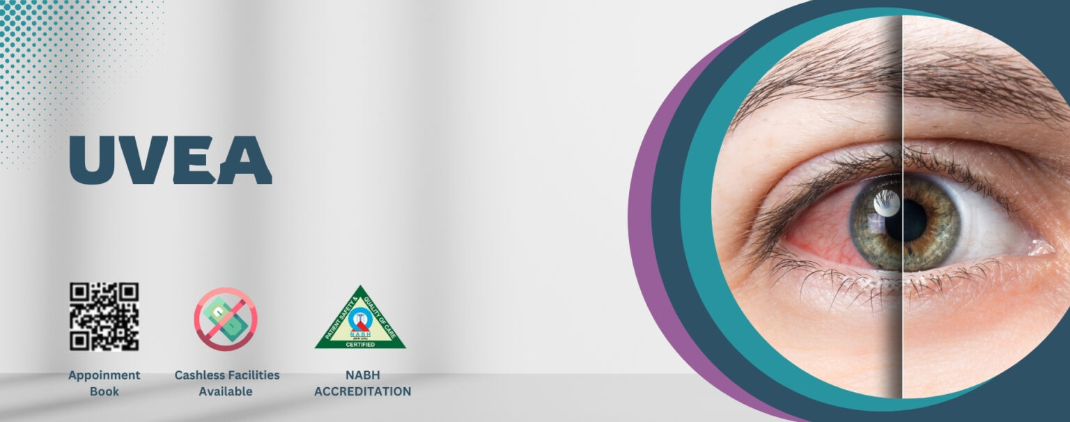 Uvea Disorders Treatment in Dadar, Matunga Hospital.