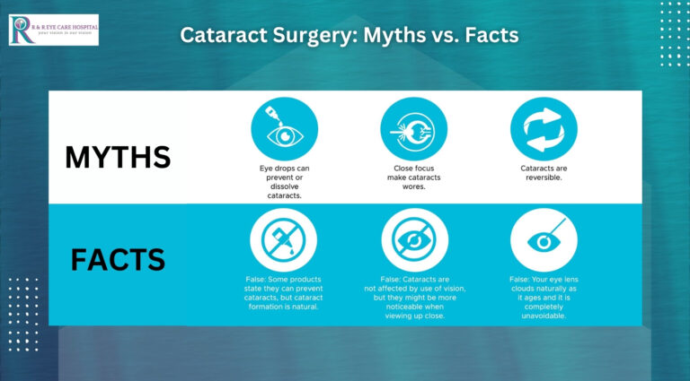 Cataract Surgery: Myths vs. Facts - RNREYECARE